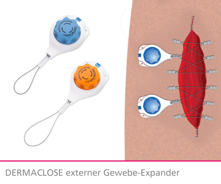 Dermaclose - TapMed Medizintechnik